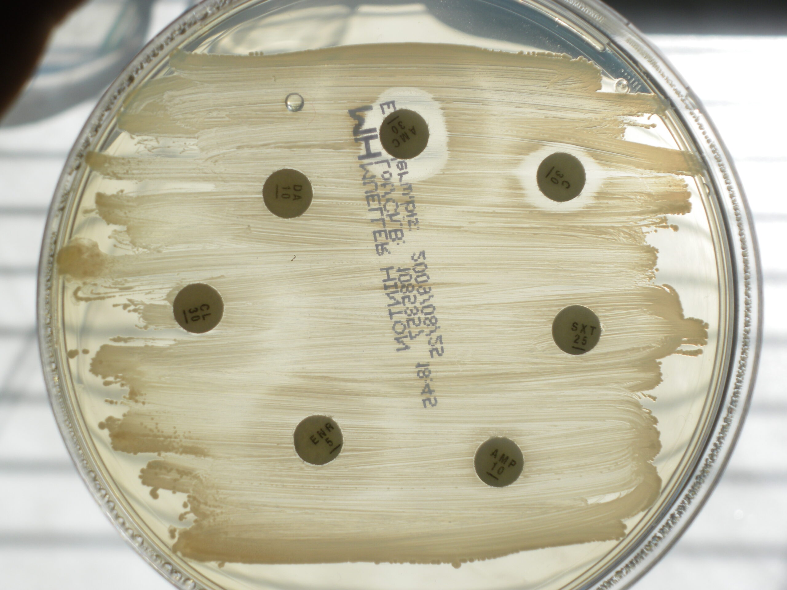 Bacterioscopia e urocultura: detecção de bactérias na urina | Estudante ...